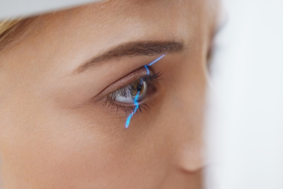 Cataract or Waterfall: The Etymology of Words in Ophthalmology ...